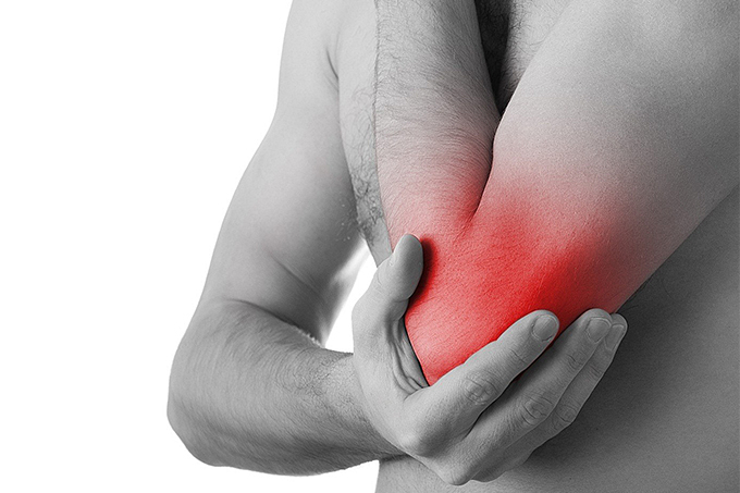 La sinovitis activa y la osteítis predicen la ocurrencia de sinovitis ...