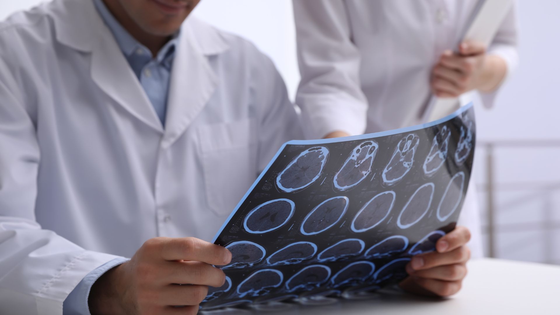 Disfunción macrovascular y su implicación clínica en la esclerosis ...